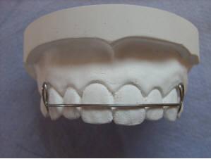 Dentistry lectures for MFDS/MJDF/NBDE/ORE: A Note on Active Components ...