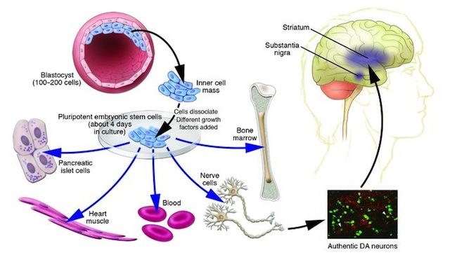 Tipos de Células-Tronco ~ Dr. WilSam