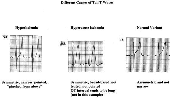 ER goldbook: EKG interpretation