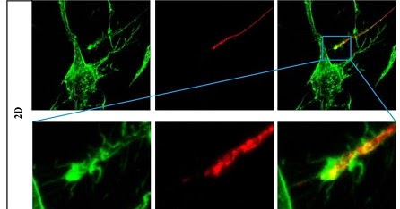 Neuromics: Staining Neurons and 3-D