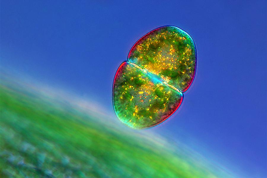 Un Mundo en Paz: En fotos: Los increíbles detalles del mundo microscópico