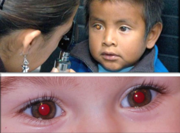 Cátedra N° 07 - Polo posterior