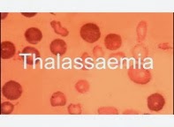 LAPORAN PENDAHULUAN THALASEMIA