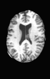 Imaging and Preprocessing Tips and Tricks: Aligning to a Standardized ...