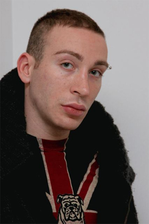 Ian Bernardo Plastic Surgery Before and After | Plastic Surgery