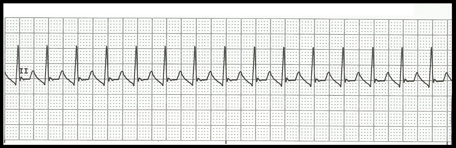 Basic EKG Rhythm Test 01