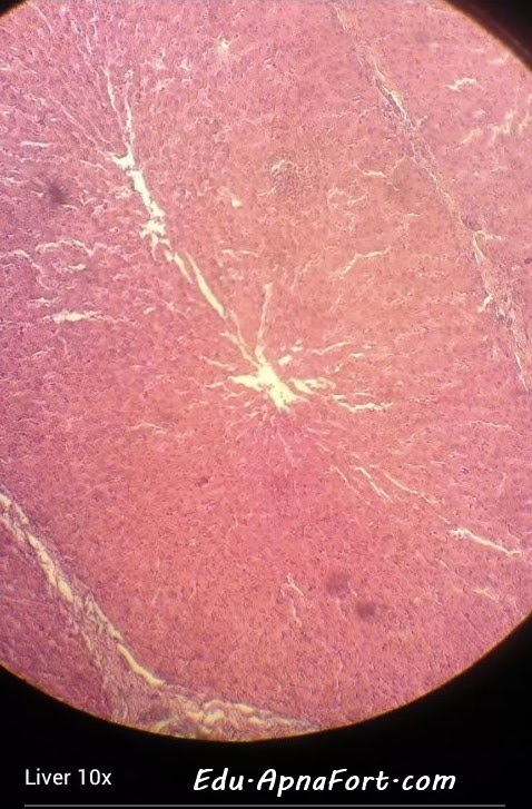 Educational Blog : Liver slides