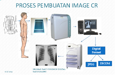 Gaya Terbaru 23+ Komponen Komputer Radiografi Gaya Terbaru 23+ Komponen Komputer Radiografi
