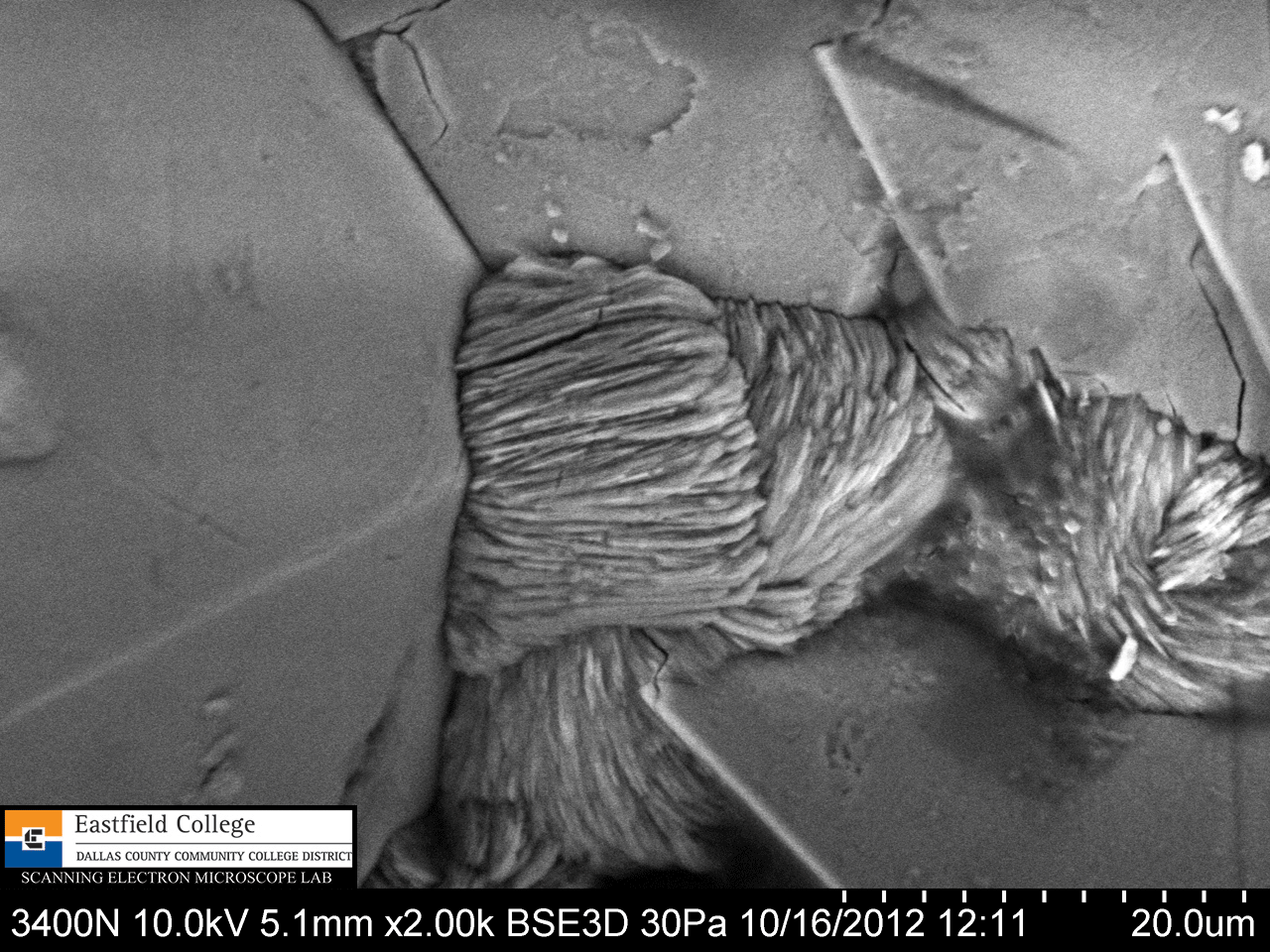 Scanning Electron Microscope Blog: A Kidney Stone - OUCH!!