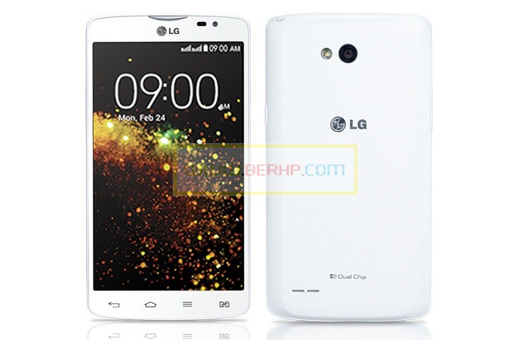 LG L80 Dual SIM, Gambar dan Pilihan Warna | Blogtainment