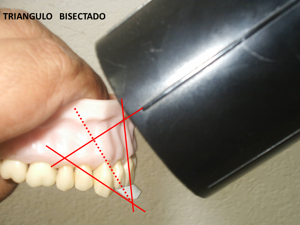 1 A 2 OTOÑO 2013: 2° Parcial Técnica Bisectriz o Bisección de Ángulo