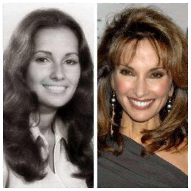 Susan Lucci Plastic Surgery