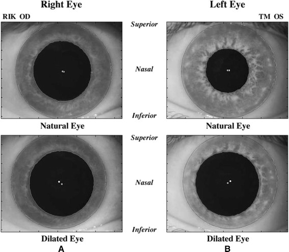 HUMAN IDENTIFICATION BASED ON IRIS DETECTION TECHNOLOGY