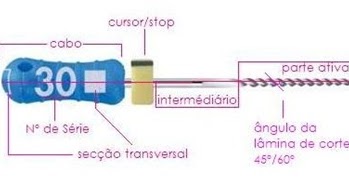O que são Limas endodônticas?