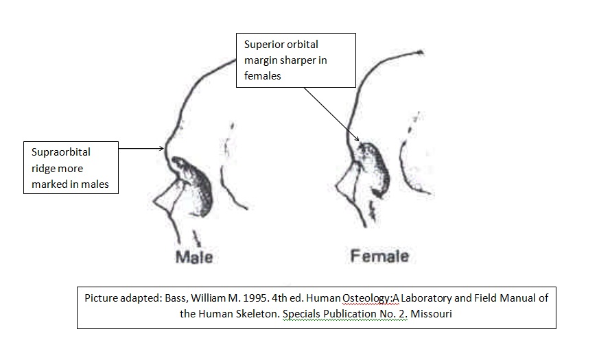 MTI: Missing Tooth Investigators: Male Skull & Female Skull (Part 1: Face)