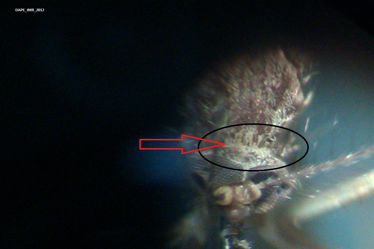 MEDICAL ENTOMOLOGY: Identification of Culex sp. (Adult)