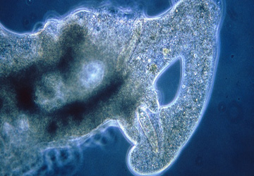 Radio Estado 32: Amibas, microscópicas pero peligrosas