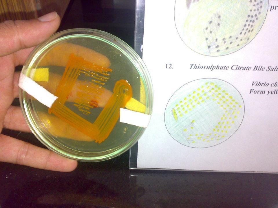 TCBS CULTURE (microbiology) ~ MBBS circle