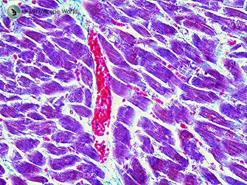 Microscope World Blog: Muscle under the Microscope