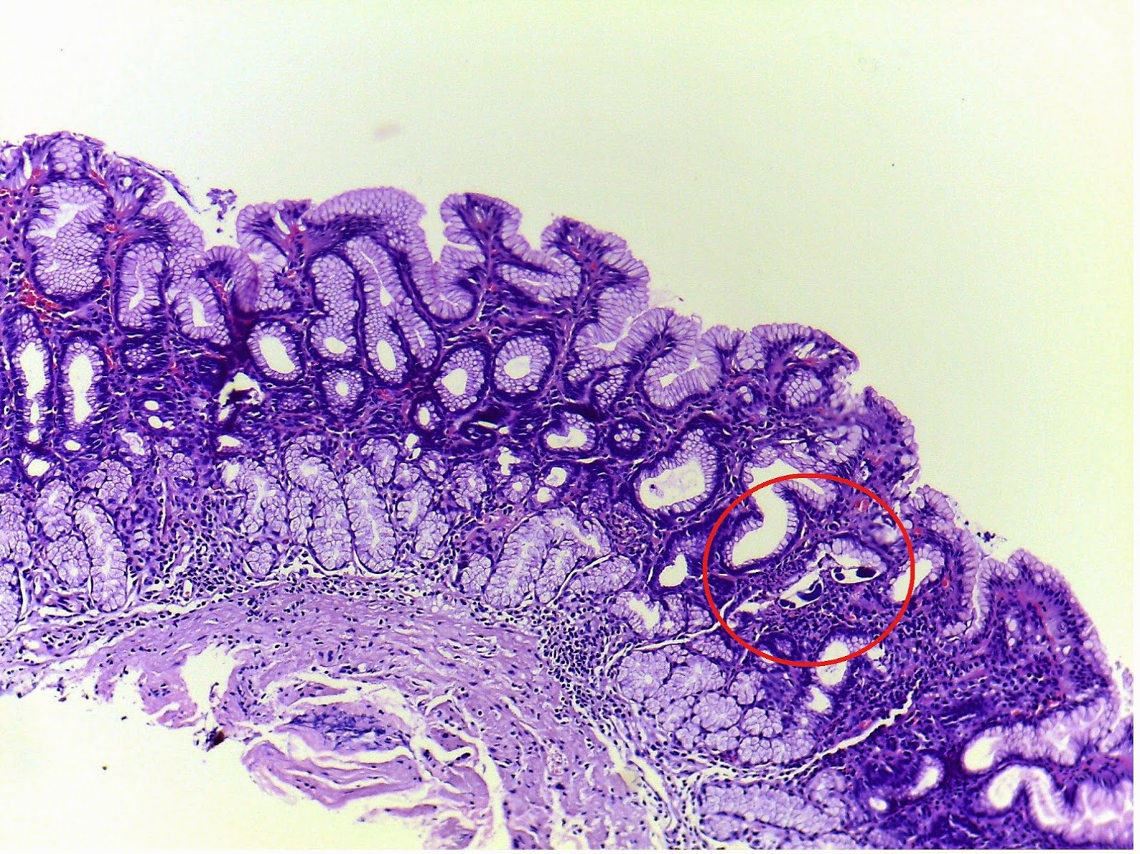 GASTROINTESTINAL AND LIVER HISTOLOGY PATHOLOGY ATLAS: DUODENUM ...