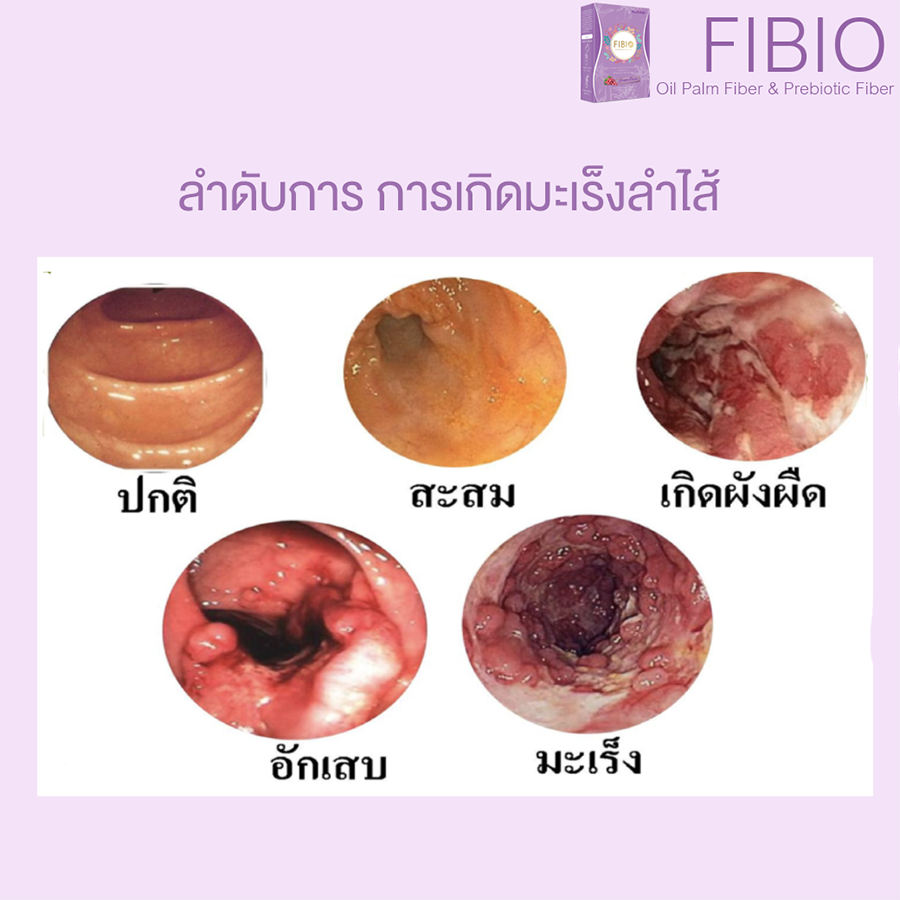 nudinar FIBIO - Oil Palm Fiber & Prebiotic Fiber: nudinar FIBIO - Palm ...