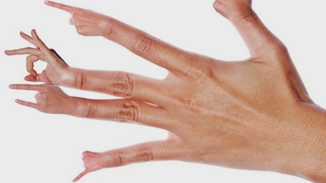 DrMitrPhysio: Weak Grip Strength Does not Predict Upper Extremity ...