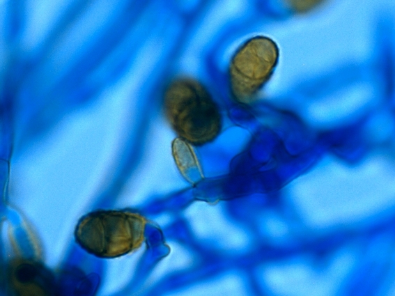 Fun With Microbiology (What's Buggin' You?): July 2015