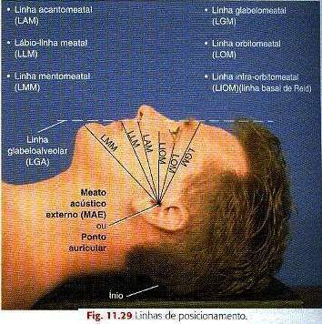 Sintonize na Radiologia: Seios da Face e Cranio