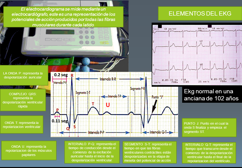 Fisiologia UAS de Gilfredo Enrique Castro Alcantar : ELEMENTOS DEL EKG ...