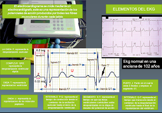 Fisiologia UAS de Gilfredo Enrique Castro Alcantar : ELEMENTOS DEL EKG ...