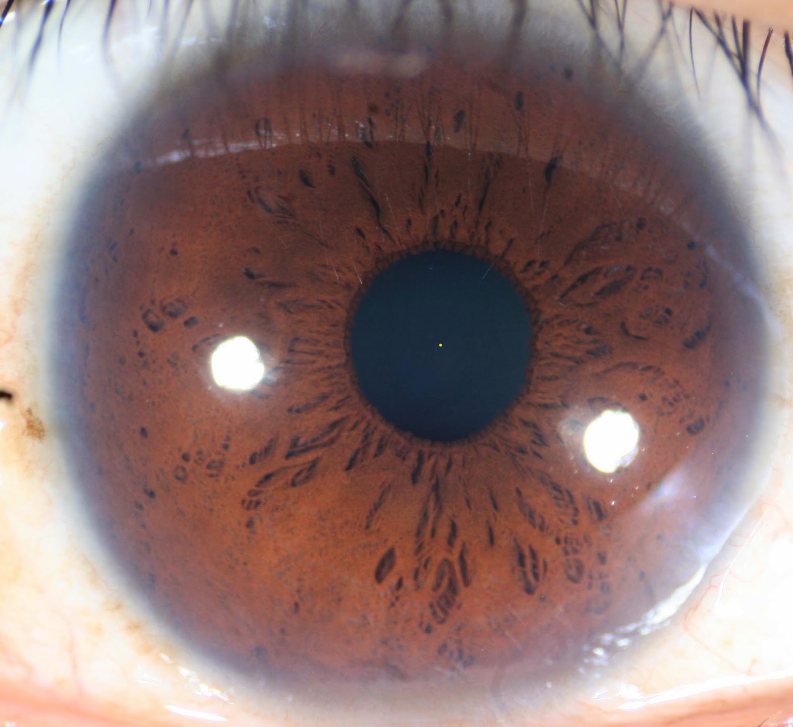 Modern & Multidimensional Iridology: The Combination of Important Iris ...