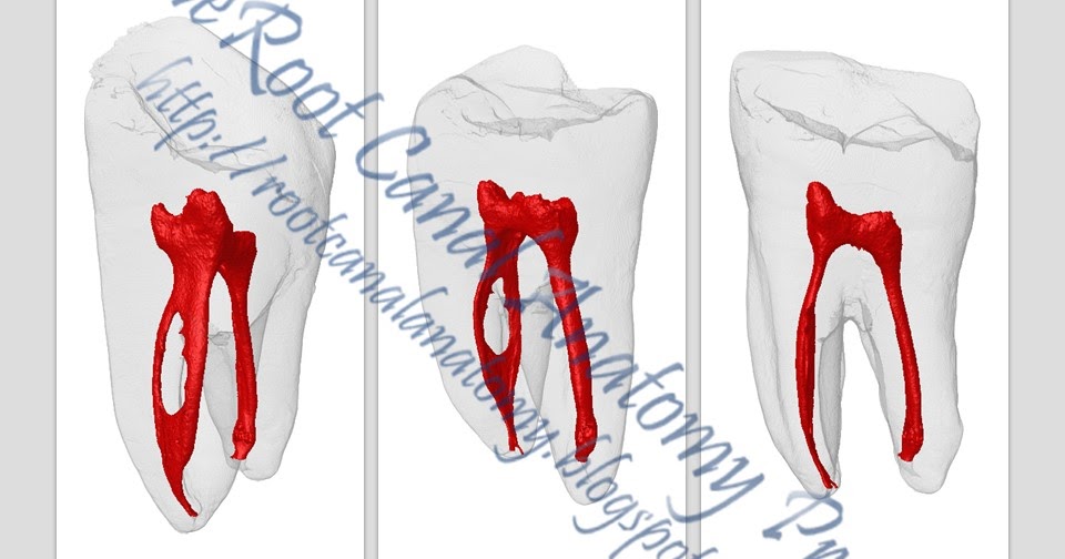 The Root Canal Anatomy Project: Mandibular First Molar