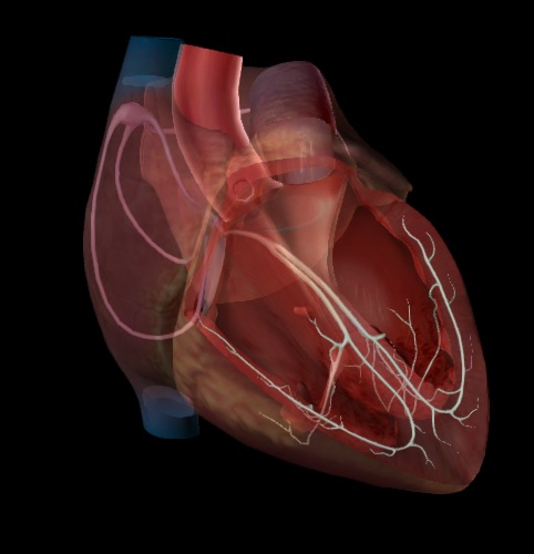 Arritmia Cardíaca e Estudo Eletrofisiológico