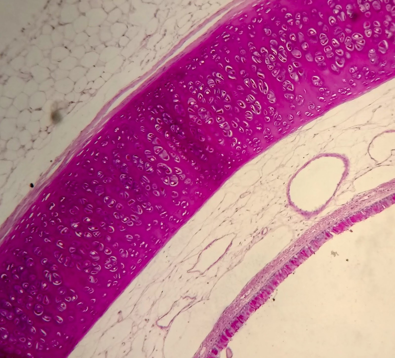Manual interactivo de tejido conectivo: Cartílago hialino en Tráquea