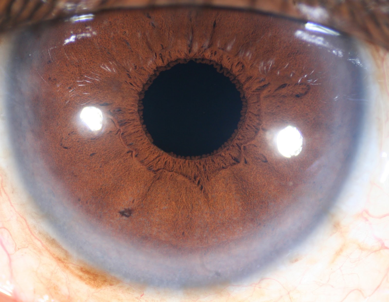 Modern & Multidimensional Iridology: The Pupil, IPB, Pupillary Zone ...