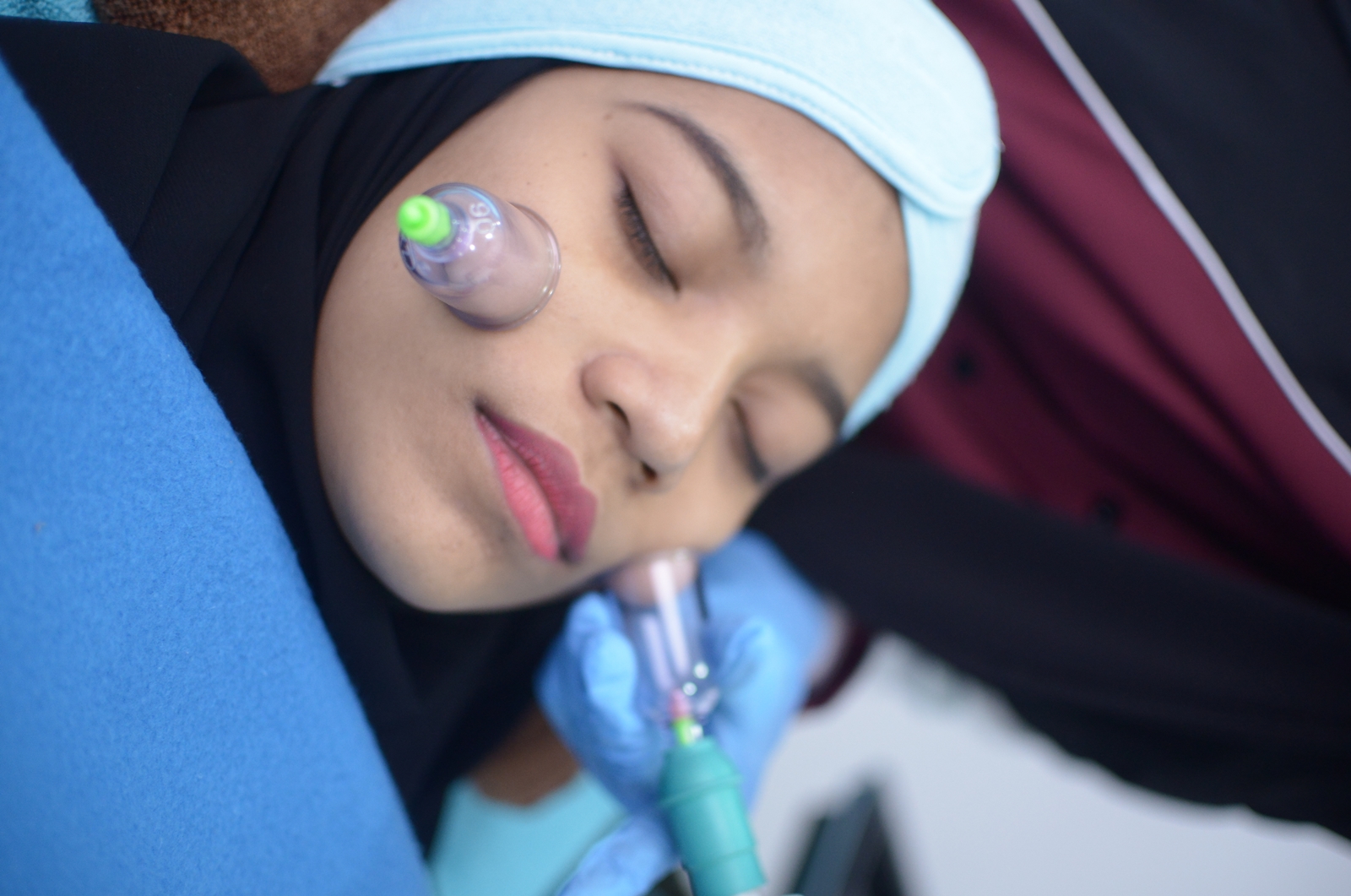 Bekam Muka - Homecare24