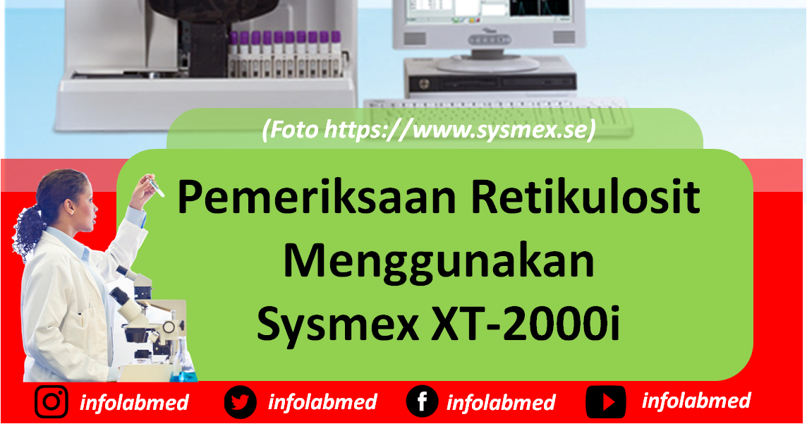 Pemeriksaan Retikulosit Dengan Alat Sysmex XT-2000i