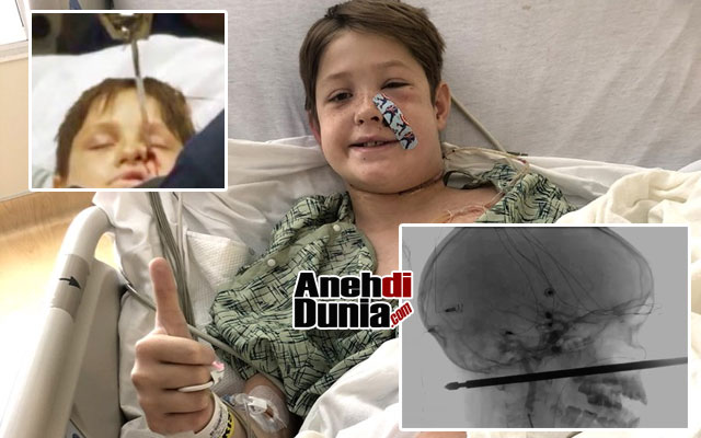 Kasus Medis Paling Aneh yang Pernah Muncul Baru Baru Ini - Berita Aneh ...