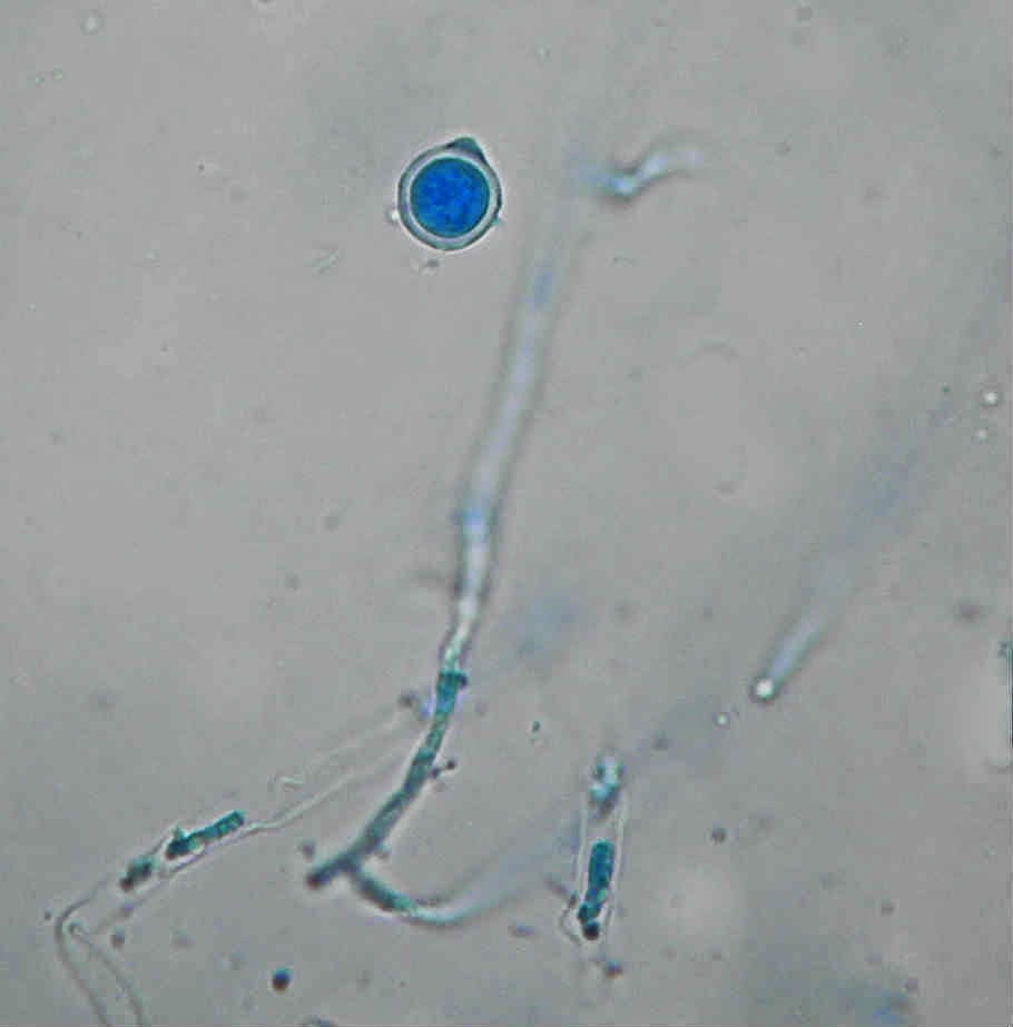 ATLAS MICOLOGIA: CONIDIOBOLUS CORONATUS
