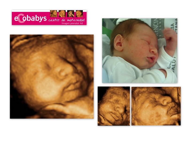 Pequesymamis: ECOBABYS. Tu bebé en 4D durante el embarazo