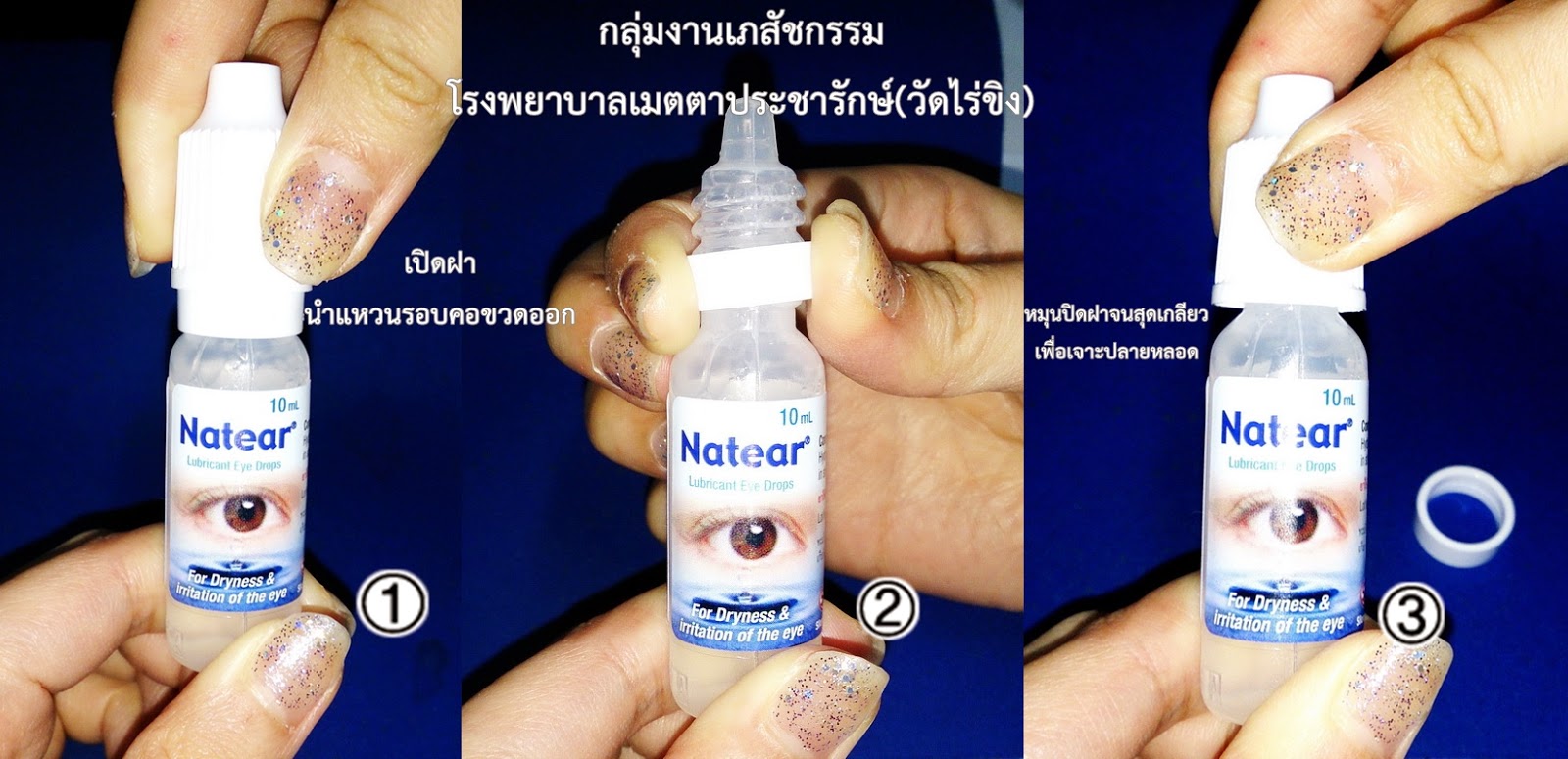 กลุ่มงานเภสัชกรรม: น้ำตาเทียม แนทเทียร์