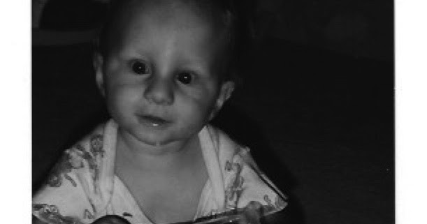 Floating Harbor Syndrome Support Group: Floating Harbor Syndrome ...