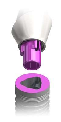 Implantes y Odontologia: Conexión Tri- Channel