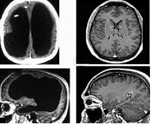 Eight Consciousnesses - Karma - Mind: Is the Brain Really Necessary ...