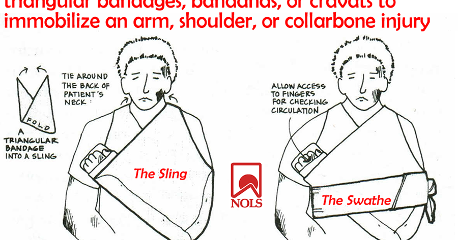 The Spec Ops Blog: Wilderness First Aid: The sling & swath—how to use ...