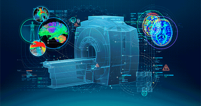 Intelligent Scanning Using Deep Learning for MRI — The TensorFlow Blog