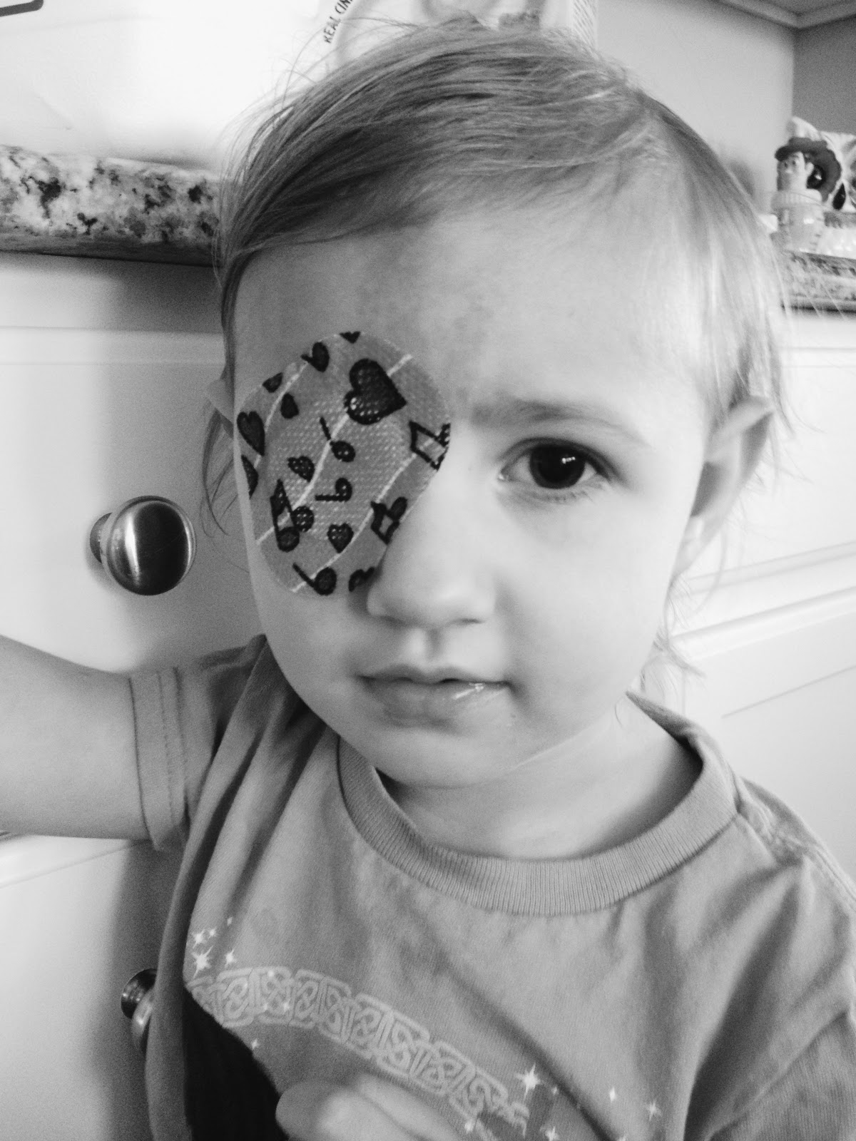 sunshine and dimples: exotropia