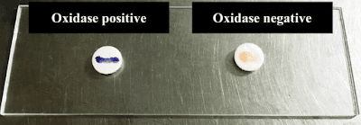 OXIDASE TEST - Microbiology Laboratory Turkey