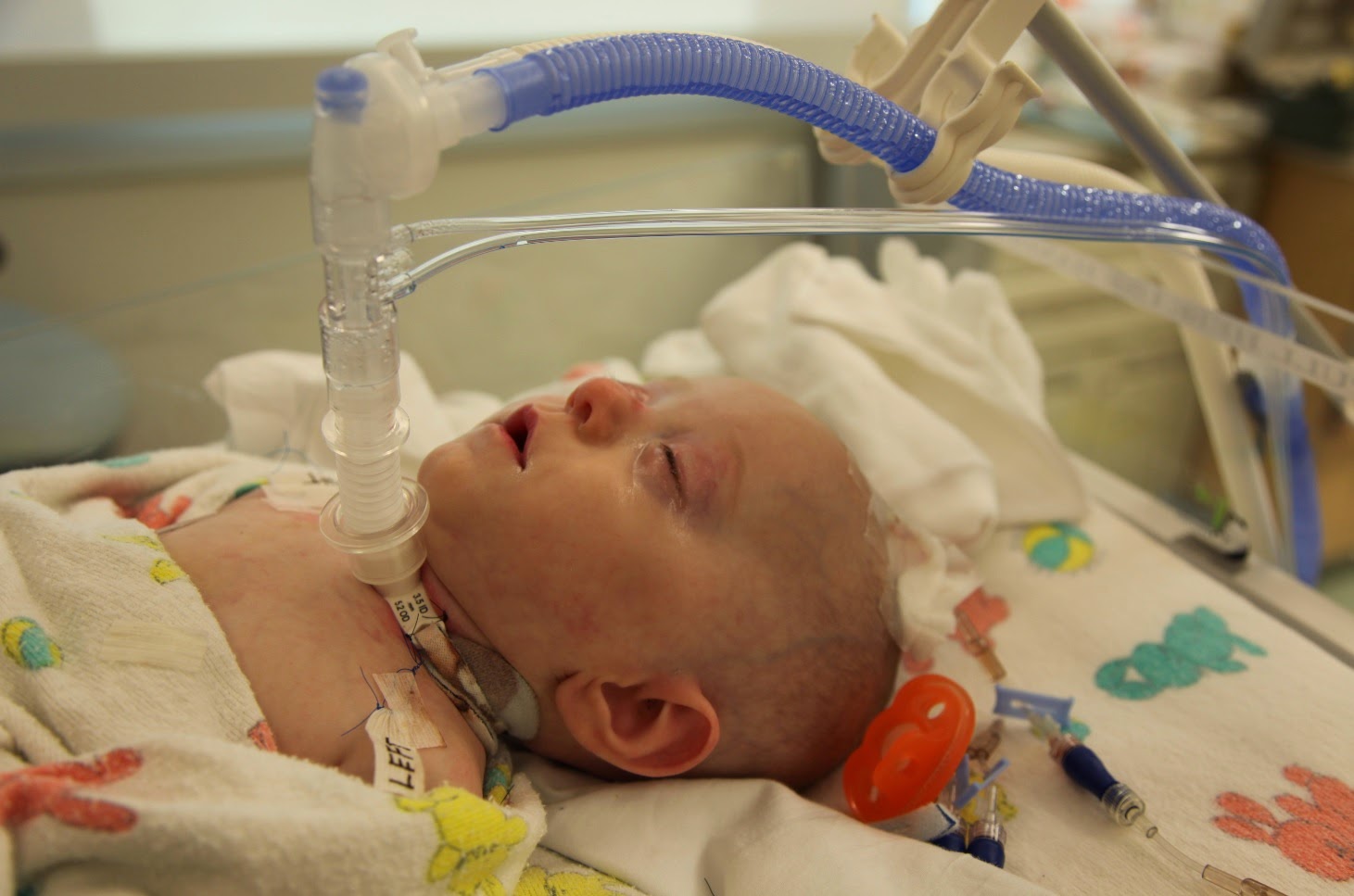 Roscoe's Story: Sedated & Paralyzed