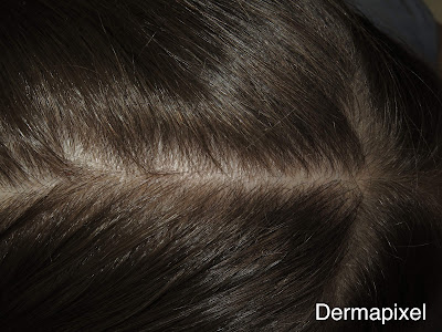 Dermapixel: abril 2018